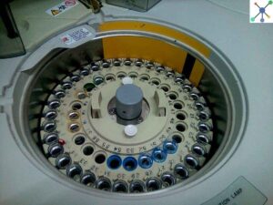 Biochemistry Analyzer Uses and Principle: A Comprehensive Guide